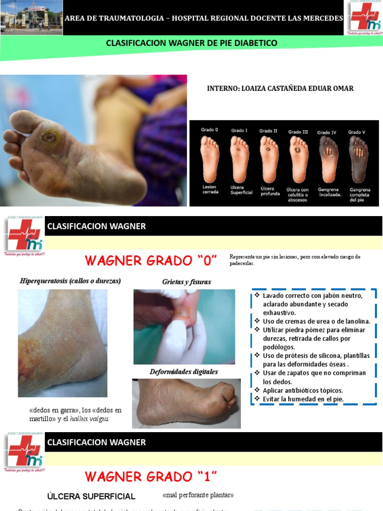 Expo Clasificacion Wagner | PDF | Medicina CLINICA | Especialidades Medicas