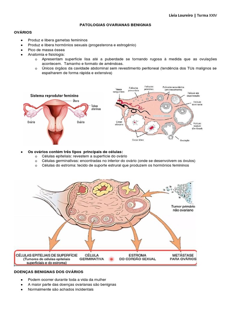 Patologias Ovarianas Benignas: Diagnóstico e Tratamento | PDF | Ovário ...