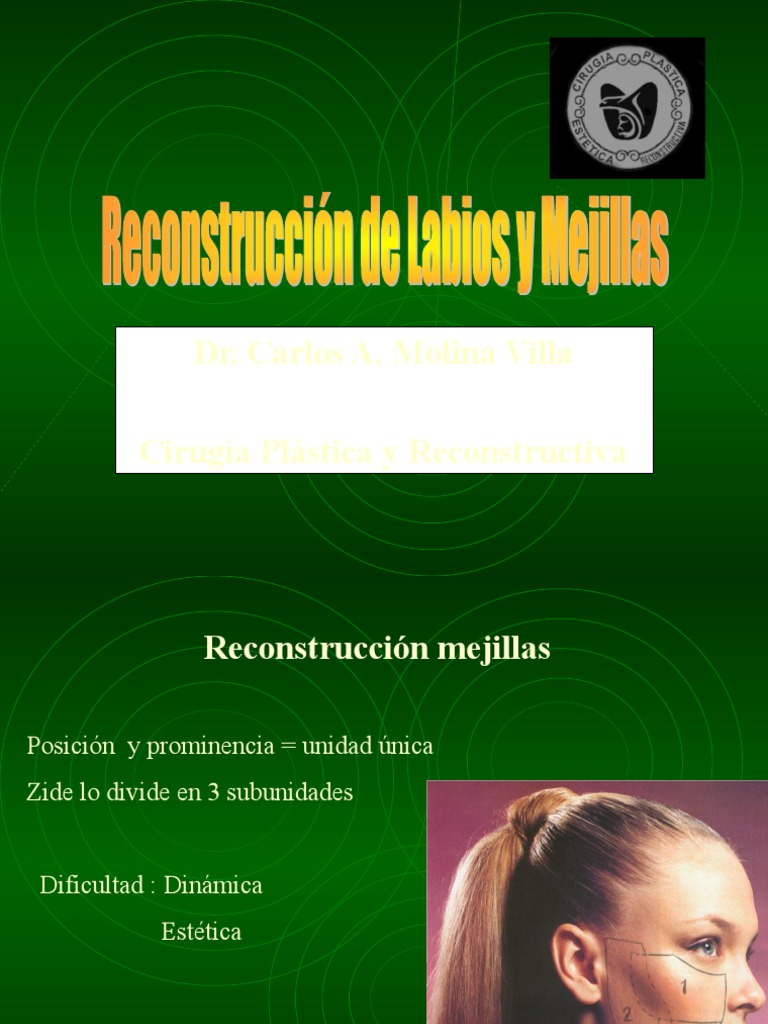 Reconstrucción de Labio y Mejilla | PDF | Labio | Medicina