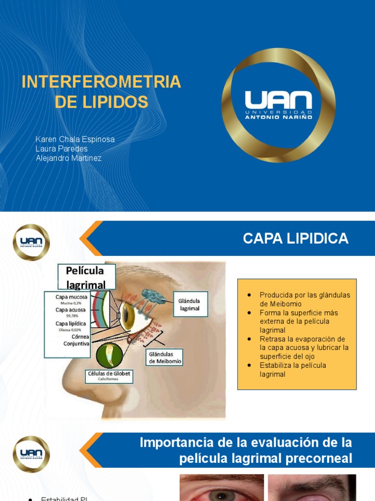 Interferometria | PDF | Córnea | Color