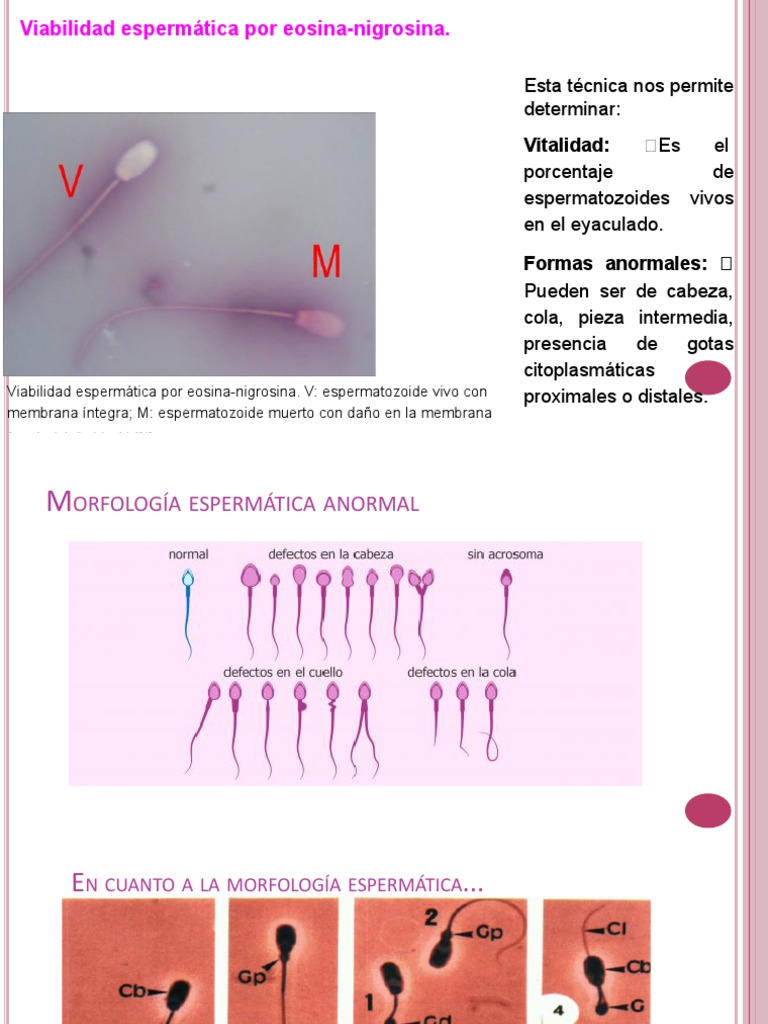Morfologia Anormal Espermatozoide | PDF | Semen | Sistema reproductivo