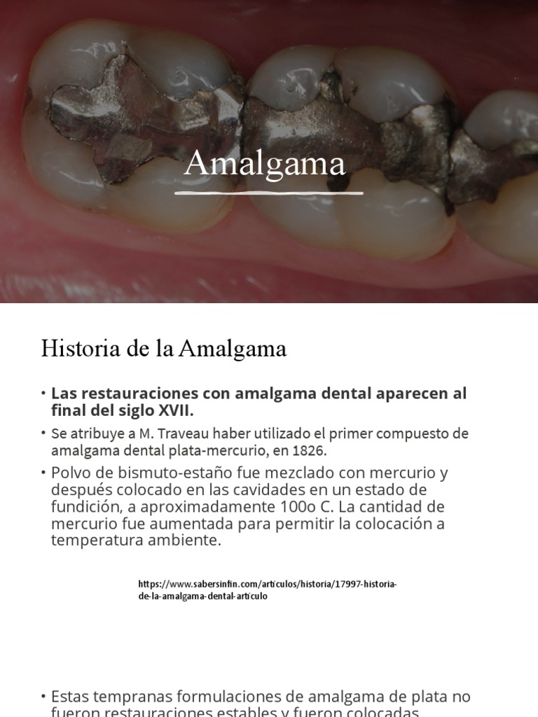 Historia y uso de la amalgama dental | PDF | Mercurio (Elemento ...