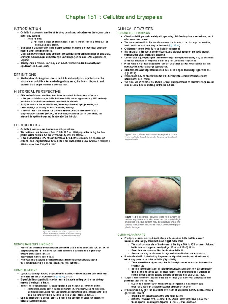 Cellulitis and Erysipelas Overview | PDF | Methicillin Resistant ...