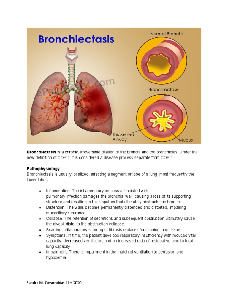 Bronchiectasis Is A Chronic, Irreversible Dilation of The Bronchi and The Bronchioles. Under The ...