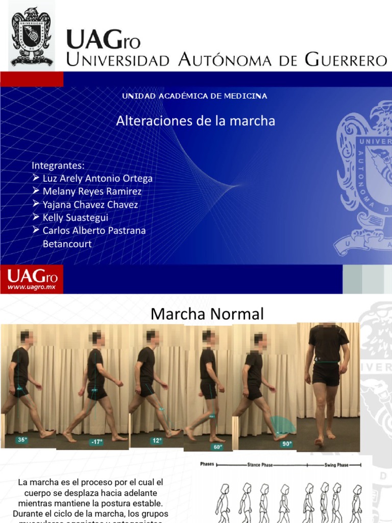 Alteraciones de La Marcha | PDF | Distonia | Sistema nervioso