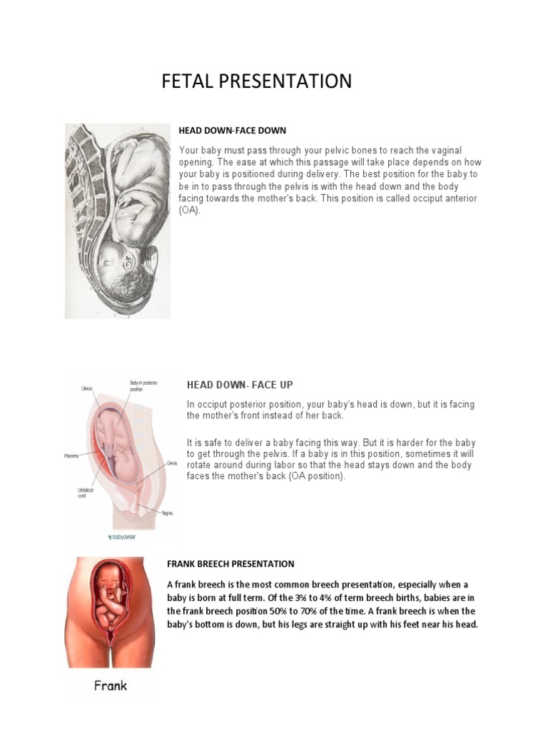 Fetal Presentation | PDF | Women's Health | Obstetrics