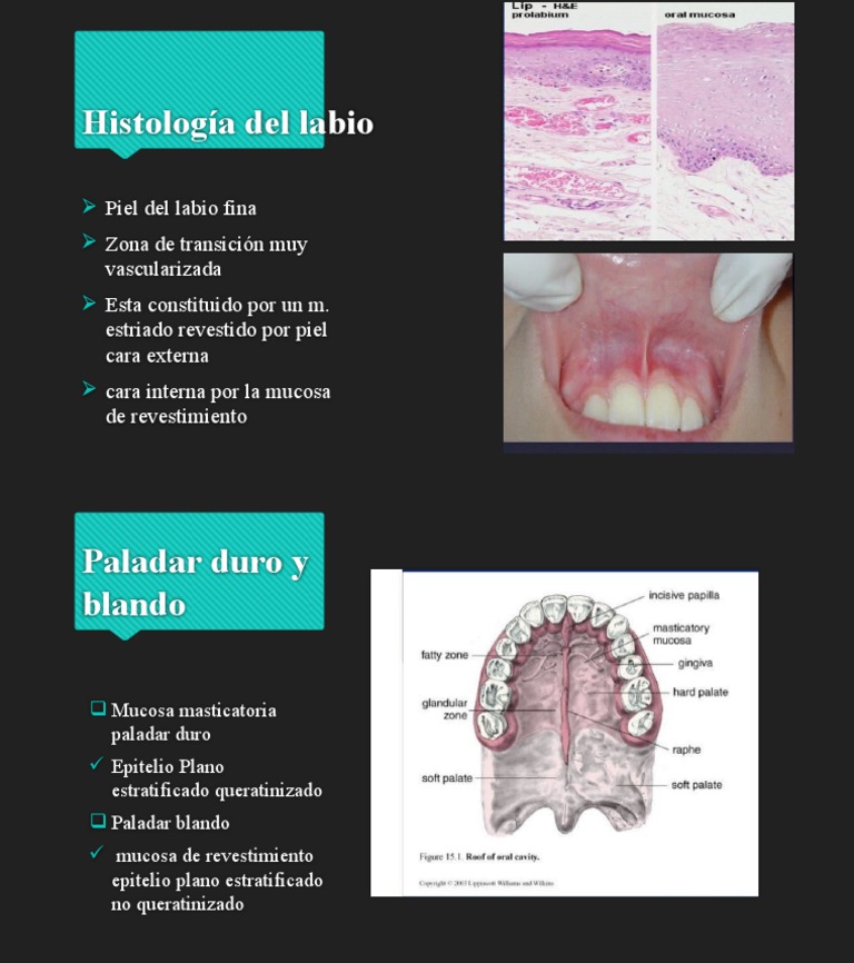 Histología Del Labio Leporino y Paladar Hendido | PDF
