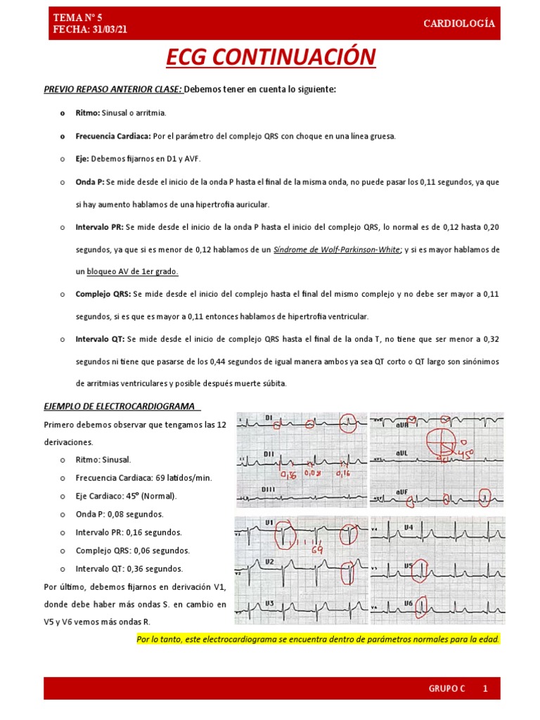 Análisis de diferentes tipos de electrocardiogramas, incluyendo ...