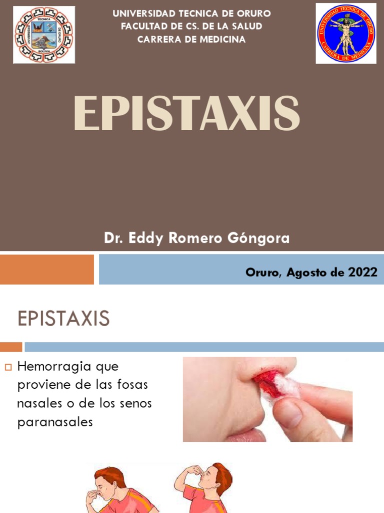 Epistaxis | PDF | Fluidos corporales | Sangre