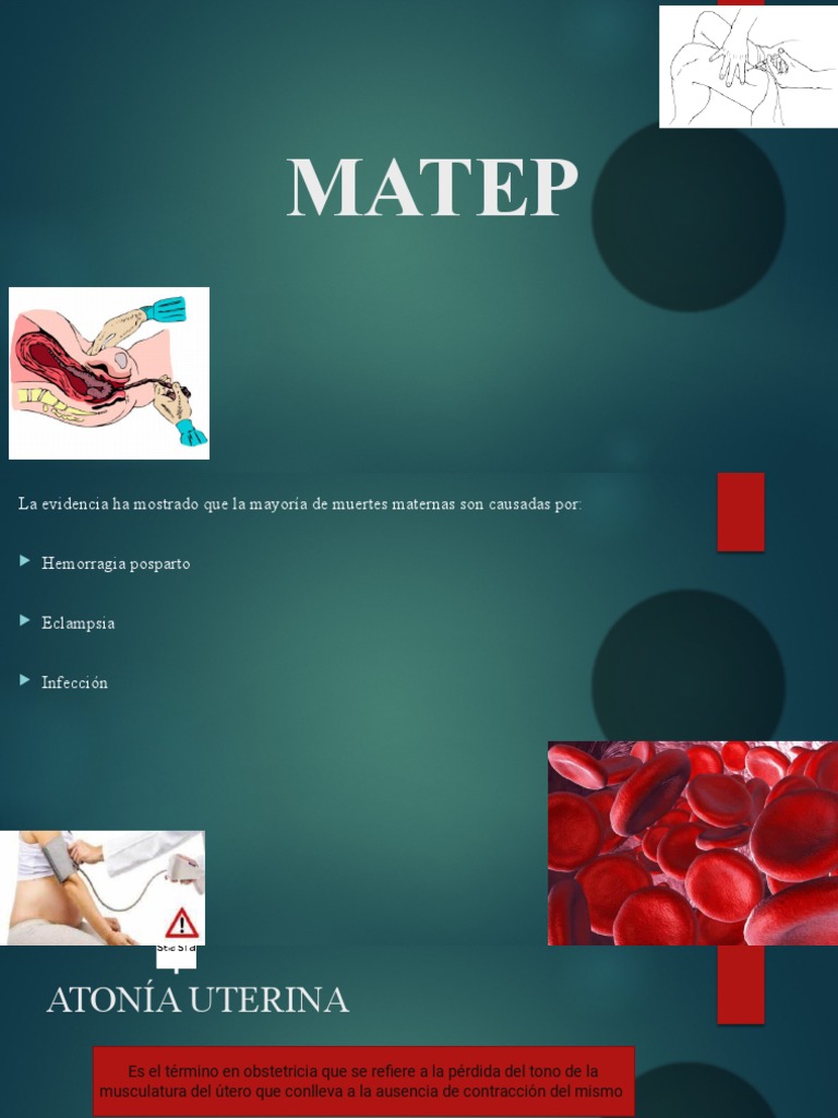 MATEP | PDF | Parto | La salud de la mujer
