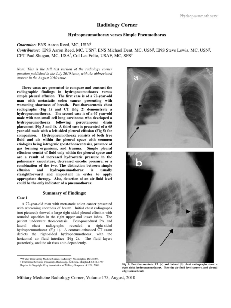 Hydropneumothorax Vs Simple Pneumothorax | PDF | Medical Specialties ...