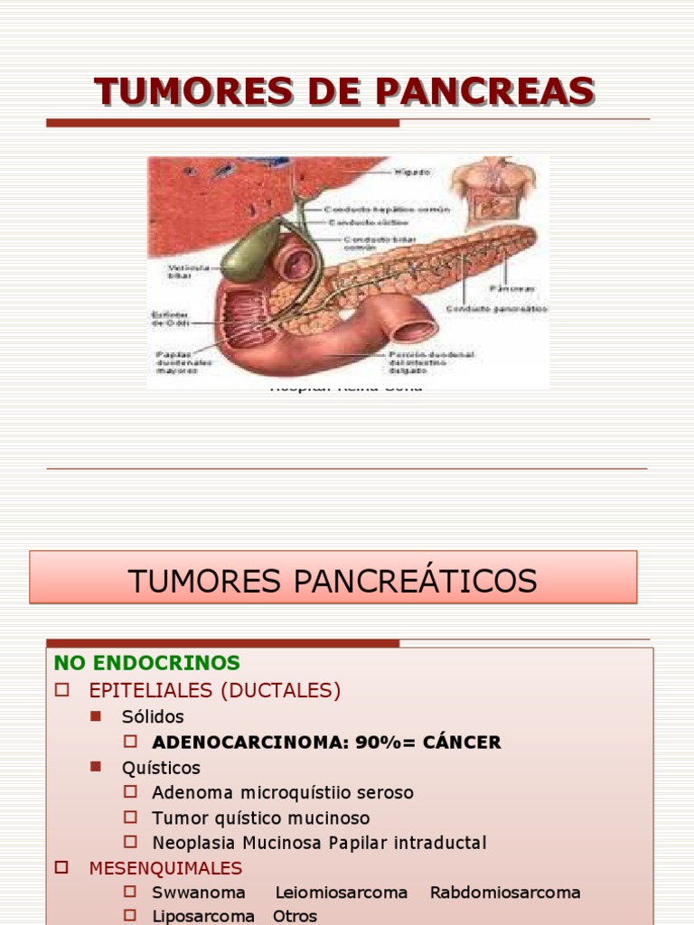 Tumores de Pancreas | PDF | Cáncer de páncreas | Cáncer