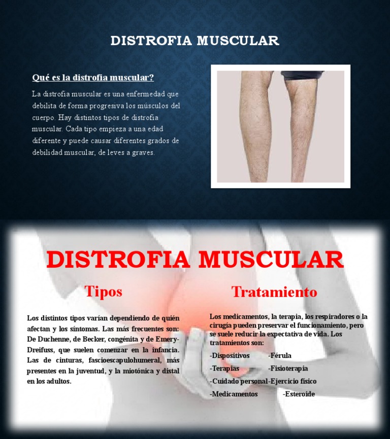 Tipos y Tratamientos de Distrofia Muscular | PDF | Relaciones ...
