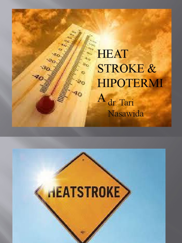 Heat Stroke & Hipotermia | PDF