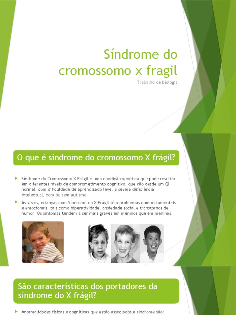 Síndrome do X Frágil: Sintomas e Tratamento | PDF | Doenças e ...