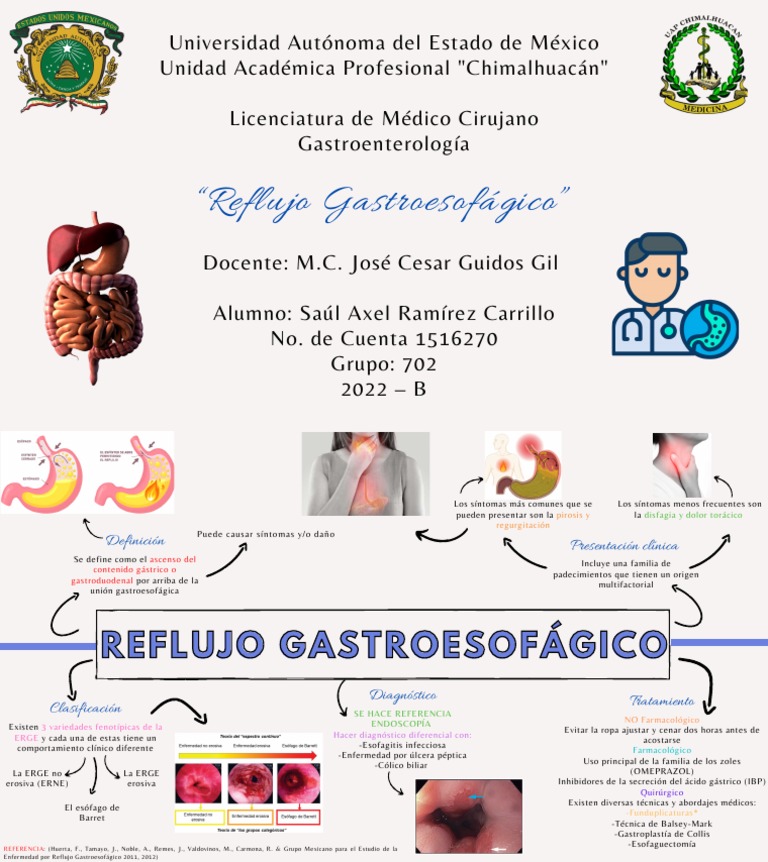 Mapa Mental de Reflujo Gastroesofágico | PDF | La enfermedad por reflujo gastroesofágico ...