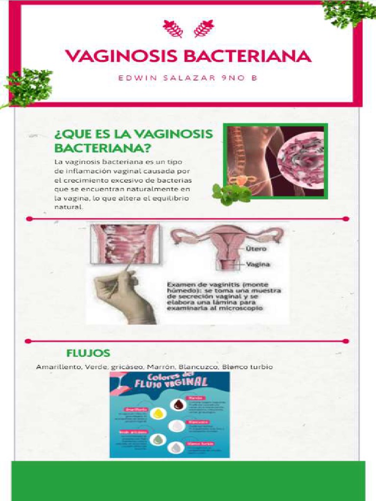 Vaginosis Bacteriana | PDF