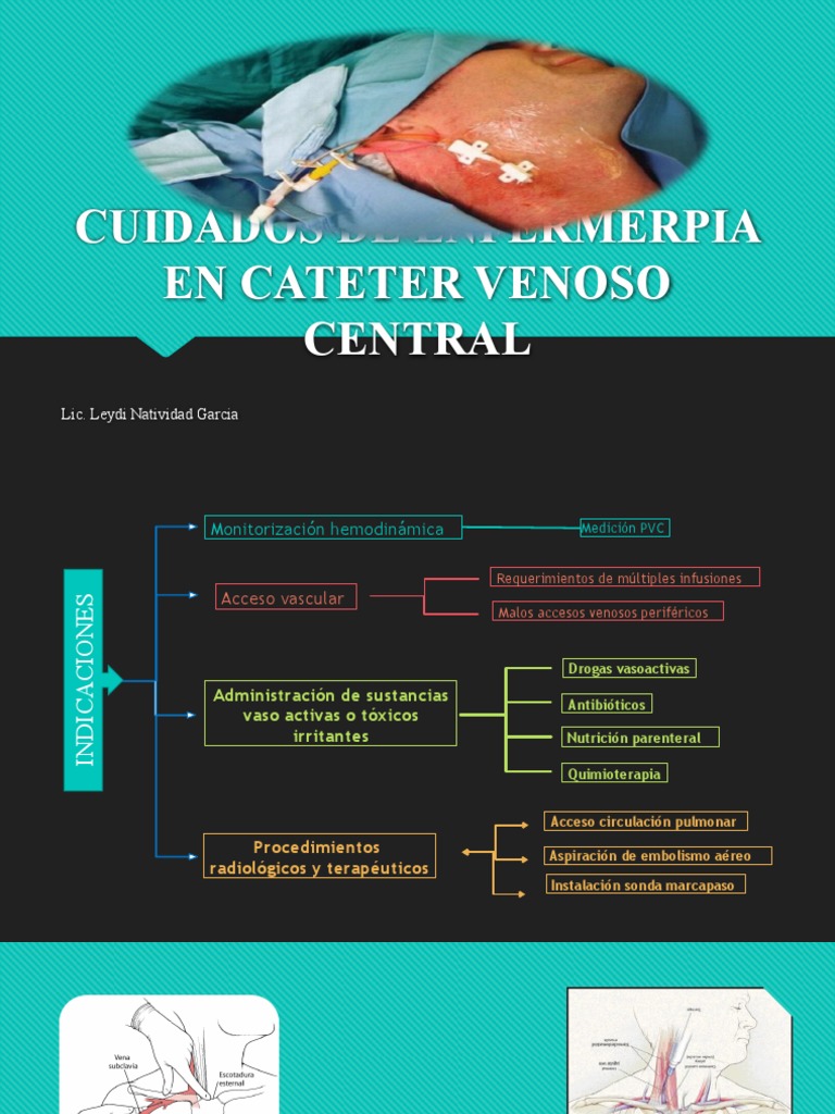 Cateter Venoso Central | PDF | Terapia intravenosa | Ciencias de la Salud