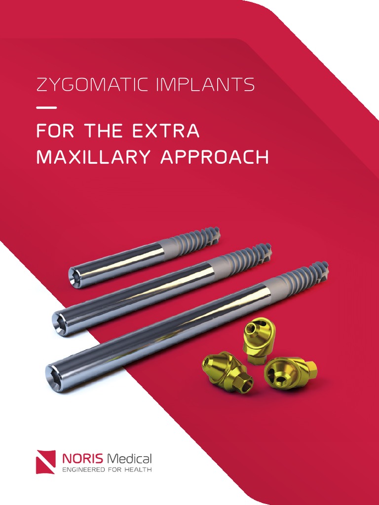 Zygomatic Implants: Extramaxillary Protocol | PDF | Dental Implant ...