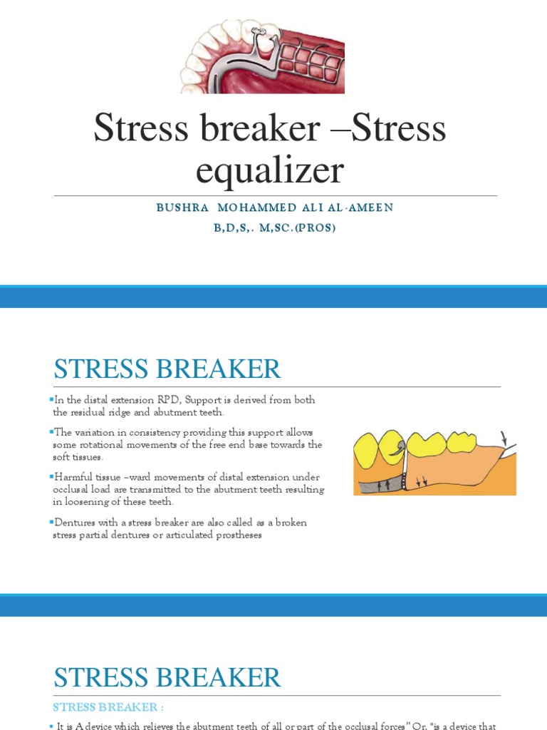 14) Stress Breaker - Stress Equalizer | PDF | Dentures | Dentistry Branches