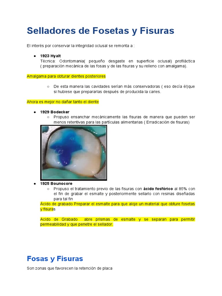 Selladores de Fosetas y Fisuras Dentales | PDF | Esmalte de dientes ...