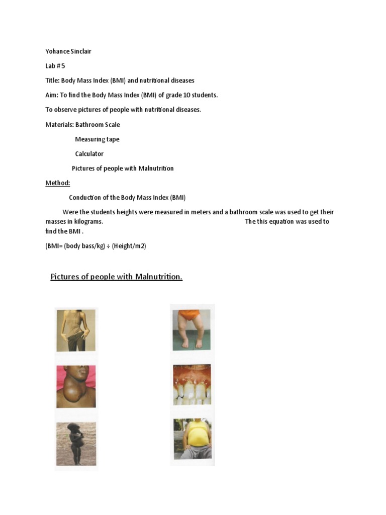 Sba 5 | PDF | Body Mass Index | Obesity