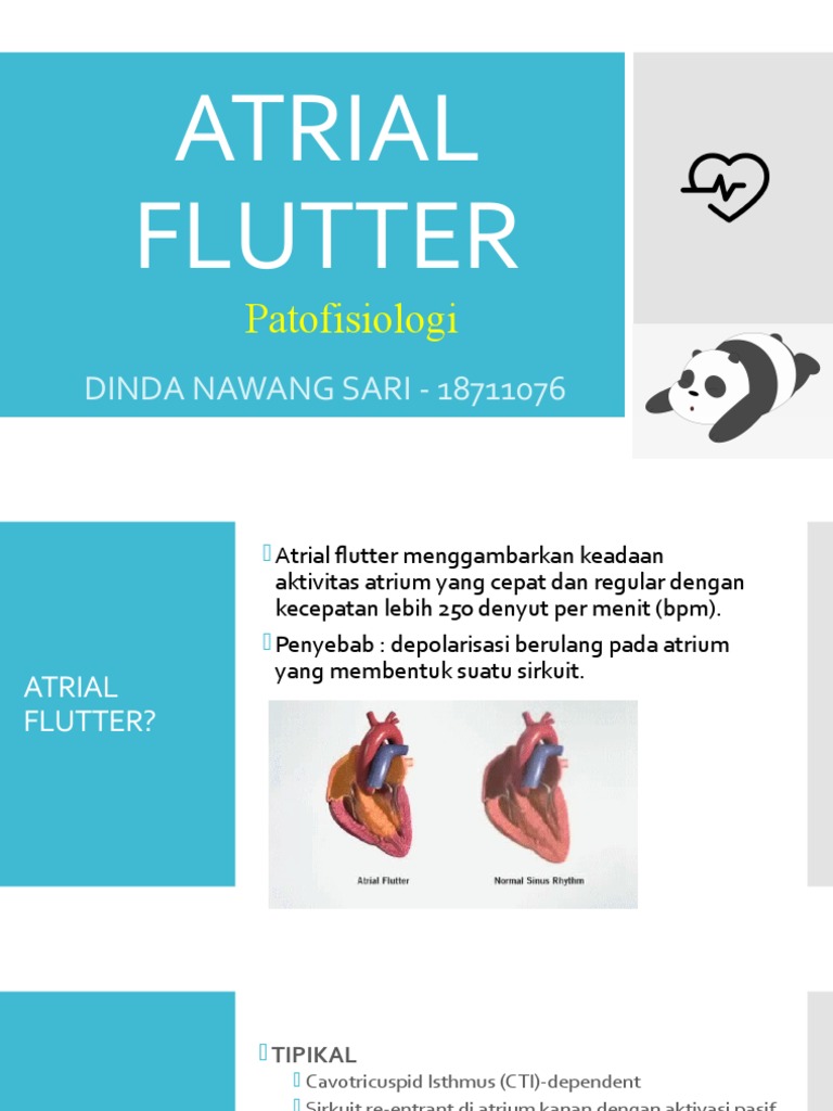 Atrial Flutter | PDF
