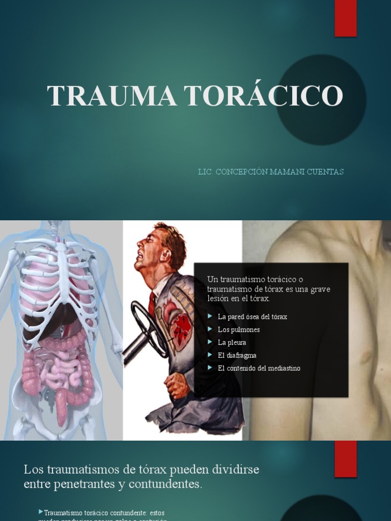 TRAUMA TORÁCICO | PDF | Lesión | Tórax