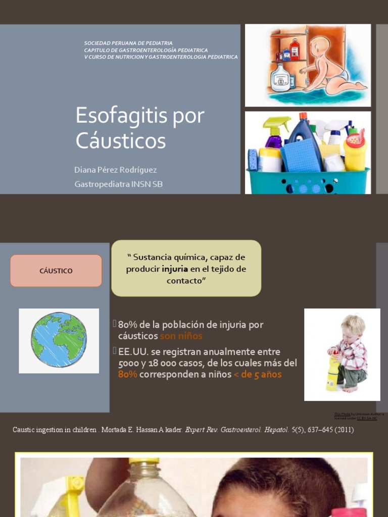 2021 Esofagitis Caustica | PDF | Especialidades Medicas | Medicina CLINICA