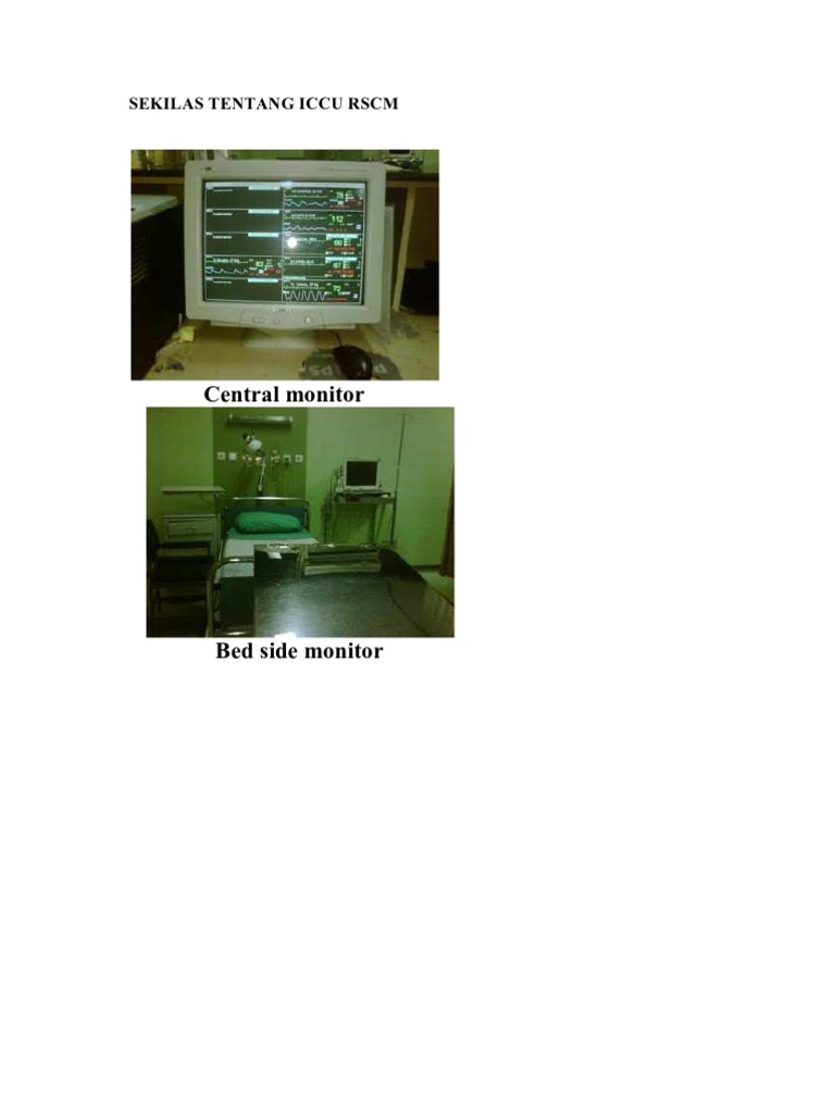 Sekilas Tentang Iccu RSCM | PDF
