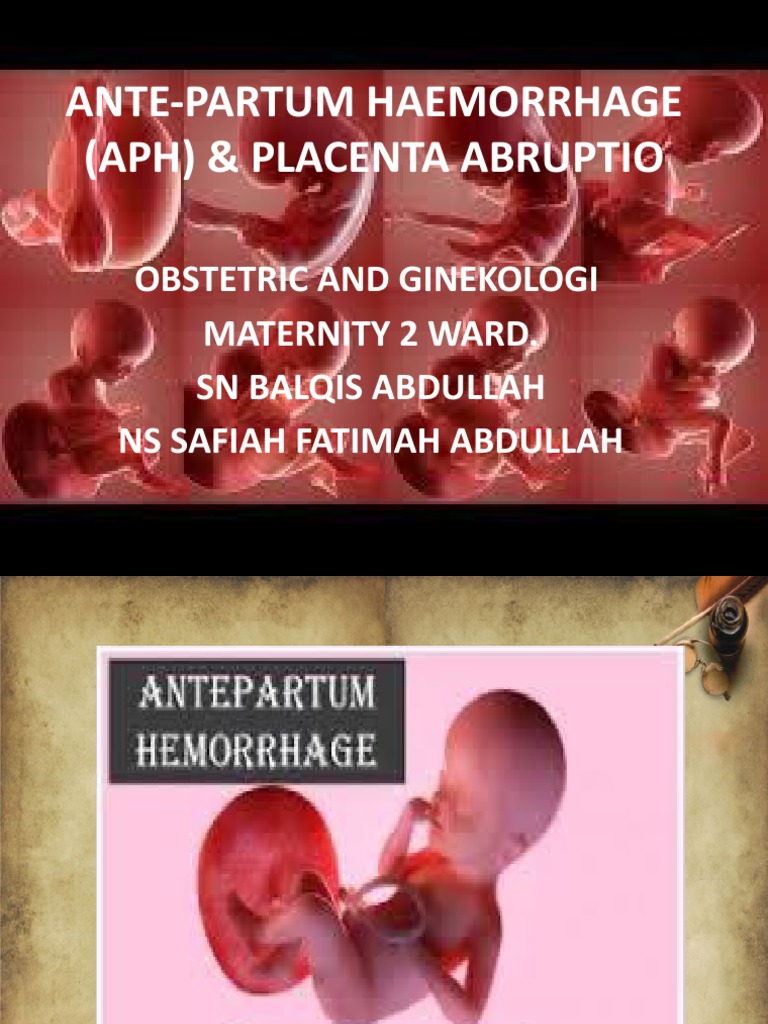 Maternity 2 Ante-Partum Haemorrhage (Aph) 26.3.2021 | PDF | Childbirth ...