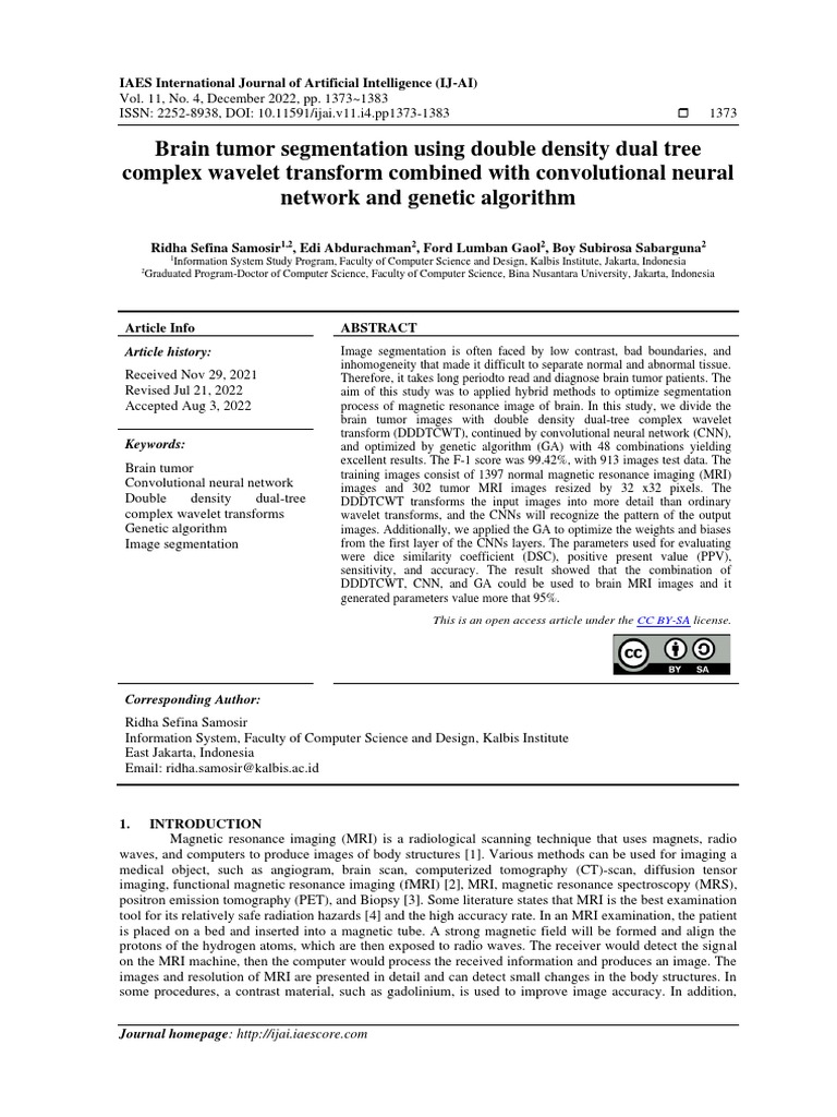 Brain Tumor Segmentation Using Double Density Dual Tree Complex Wavelet Transform Combined With