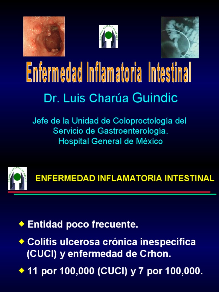 CUCI Presentación Torreón | PDF | Enfermedad de Crohn | Enfermedad ...
