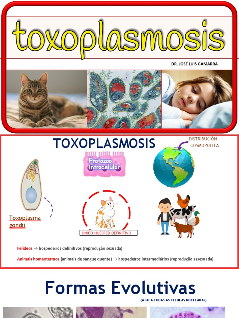Toxoplasmosis - Dr. José Luis Gamarra | PDF | Medicina | Inmunología