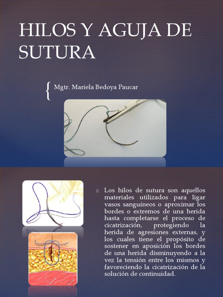 Guía Completa de Hilos de Sutura | PDF | Sutura Quirúrgica | Herida