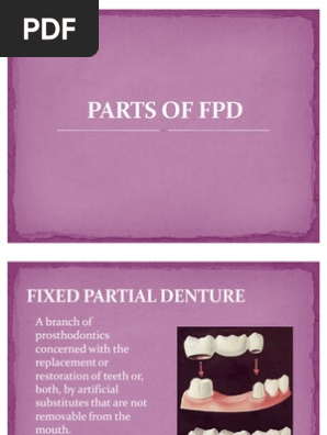 Parts Of Fixed Partial Denture