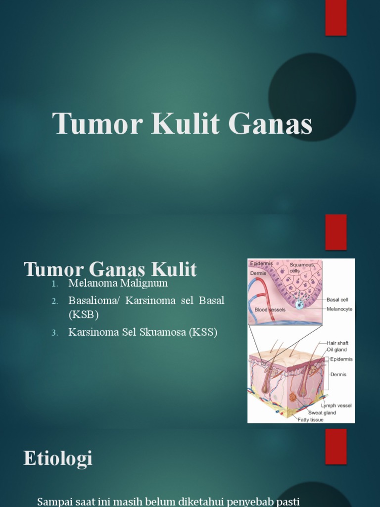 Tumor Kulit Edit | PDF