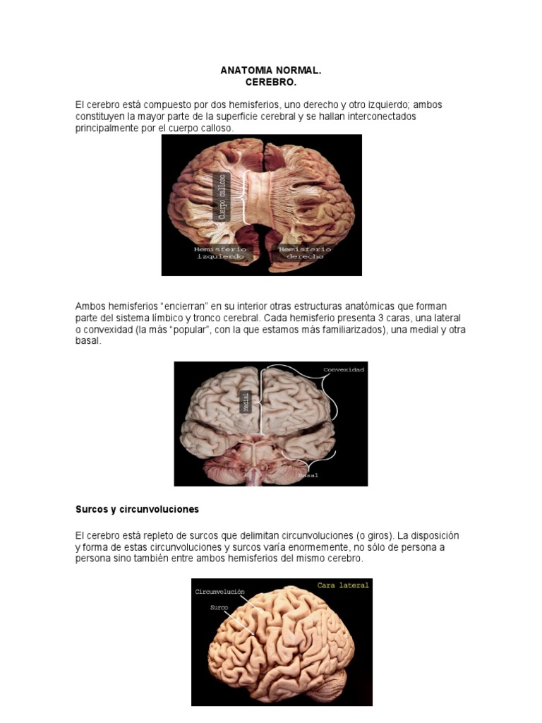 Anatomía Normal Del Cerebro Human Brain. Coloured Magnetic Resonance