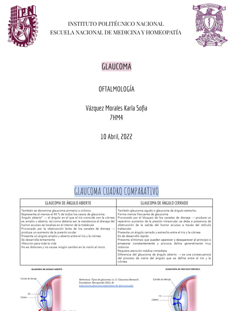 GLAUCOMA | PDF | Glaucoma | Ojo humano