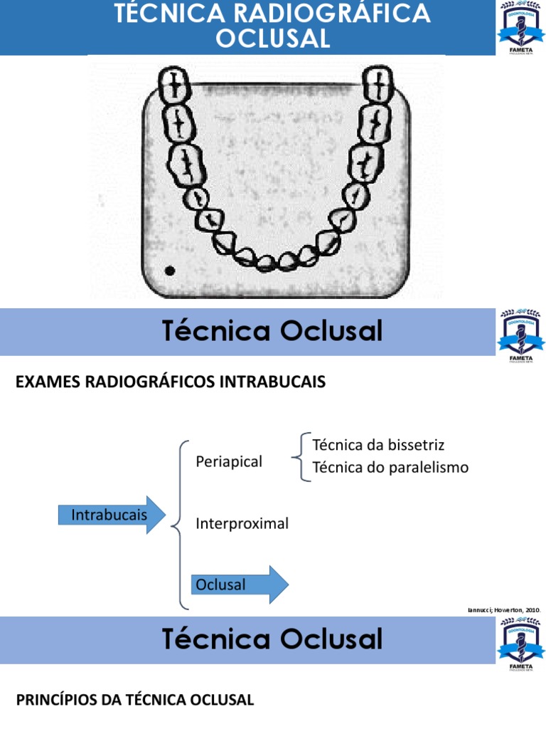 Técnicas Oclusais Radiográficas: Guia Completo | PDF | Dente | Cabeça e ...