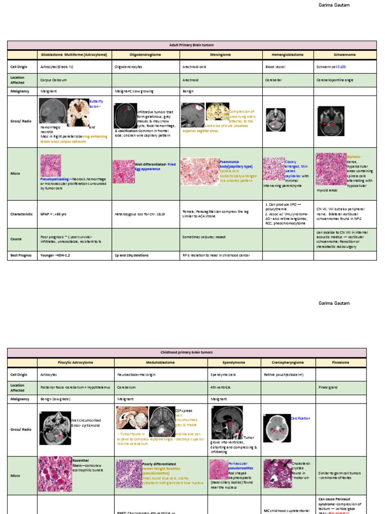 Brain Tumors | PDF | Brain Tumor | Cancer