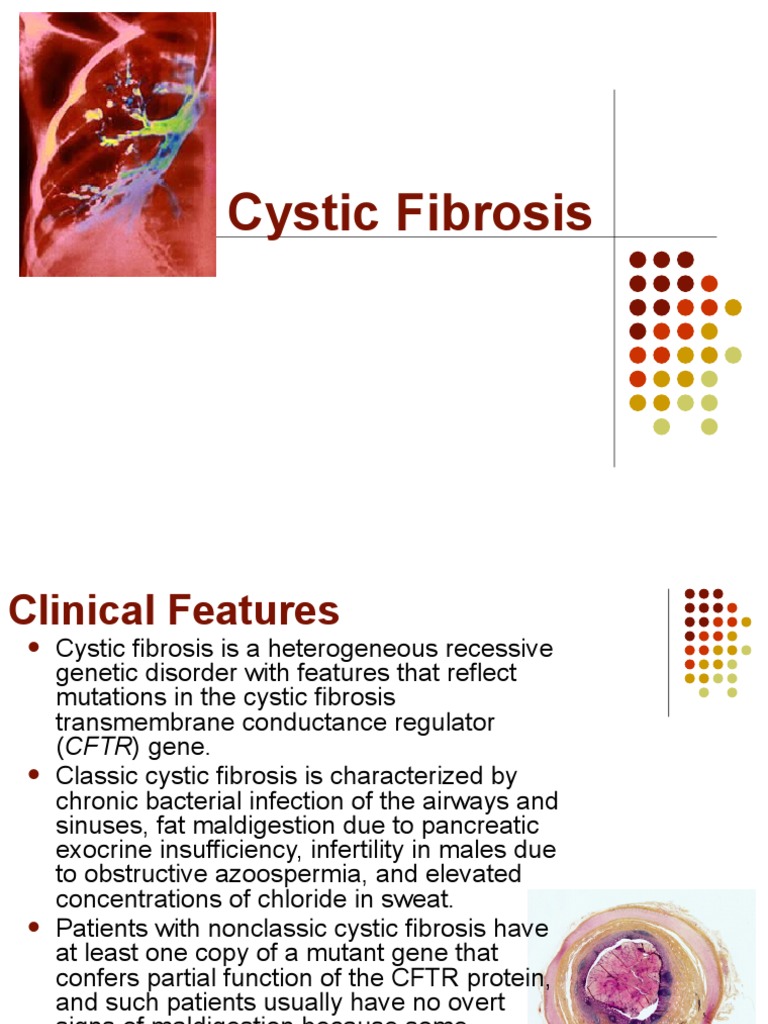 Cystic Fibrosis | PDF | Biology | Medical Specialties