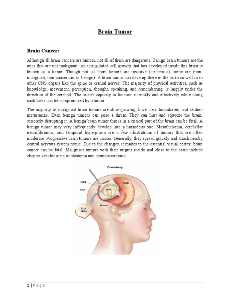 Brain Tumor | PDF | Brain Tumor | Cancer
