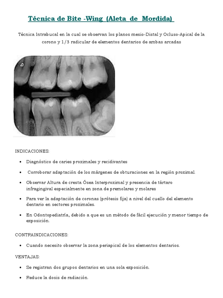 Técnica de Radiografía Bite Wing | PDF