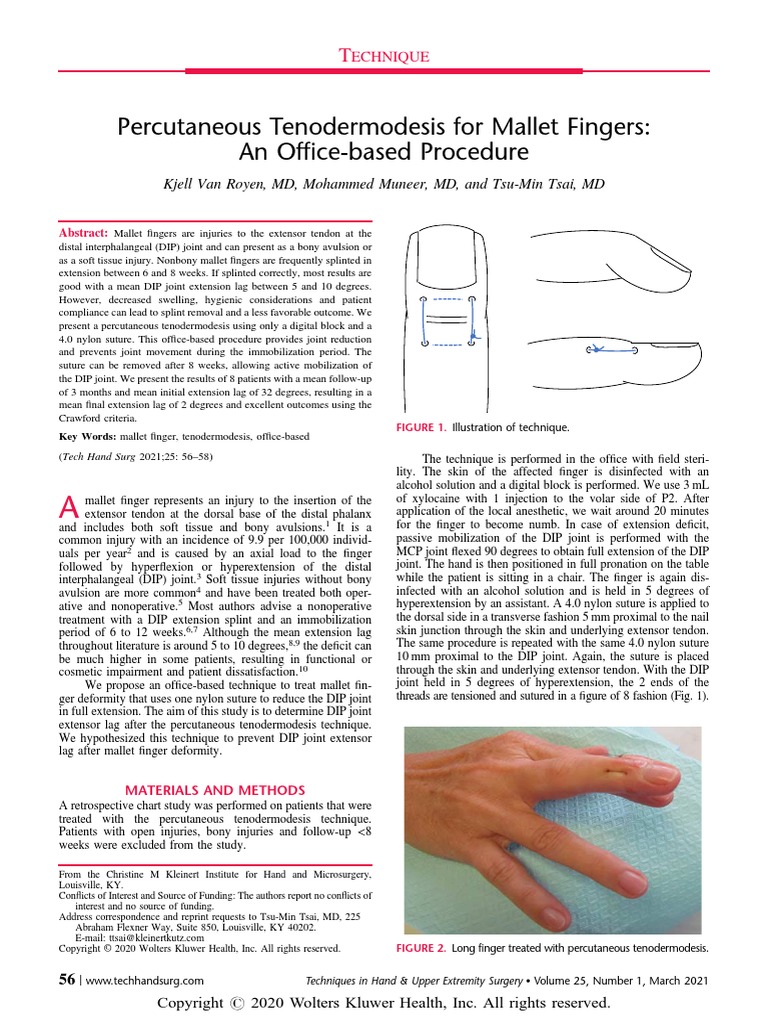 Percutaneous Tenodermodesis For Mallet Fingers An Office Based ...
