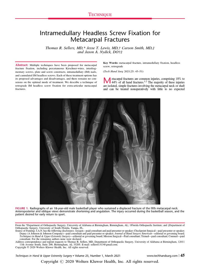 Intramedullary Headless Screw Fixation For Metacarpal Fractures | PDF | Hand | Surgery