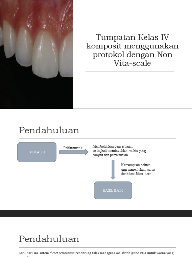 RESTORASI GIGI ANTERIOR MENGGUNAKAN RESIN KOMPOSIT TANPA SHADE GUIDE VITA | PDF