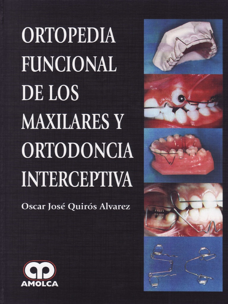 Ortopedia de Los Maxilares LIBRO 148 | PDF | Diente | Odontología