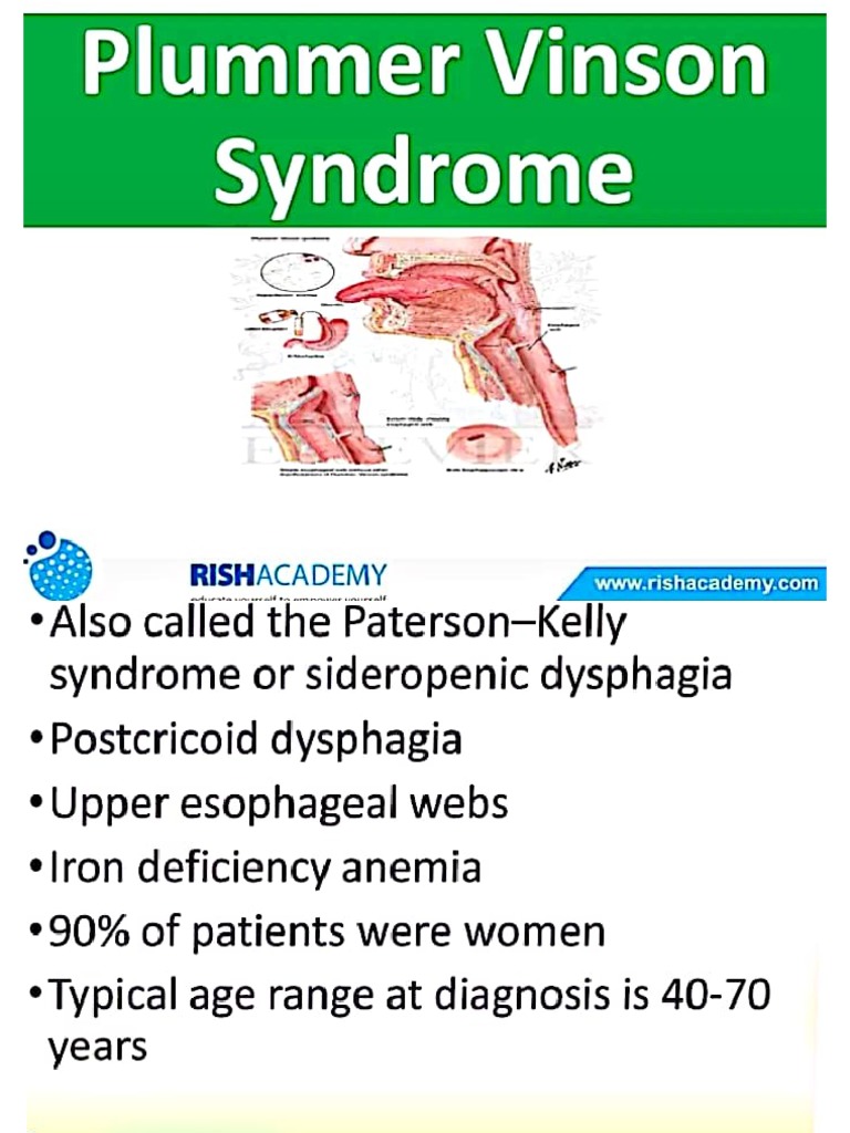 Plummer Vinson Syndrome | PDF