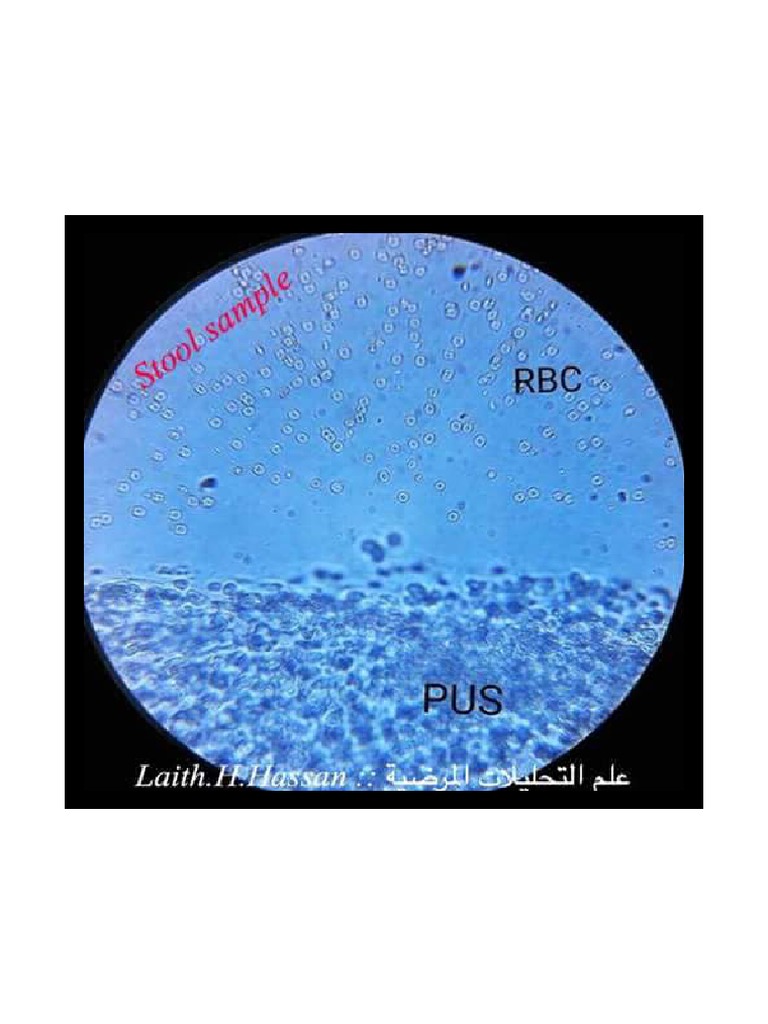 Stool Analysis Under Microscopic | PDF